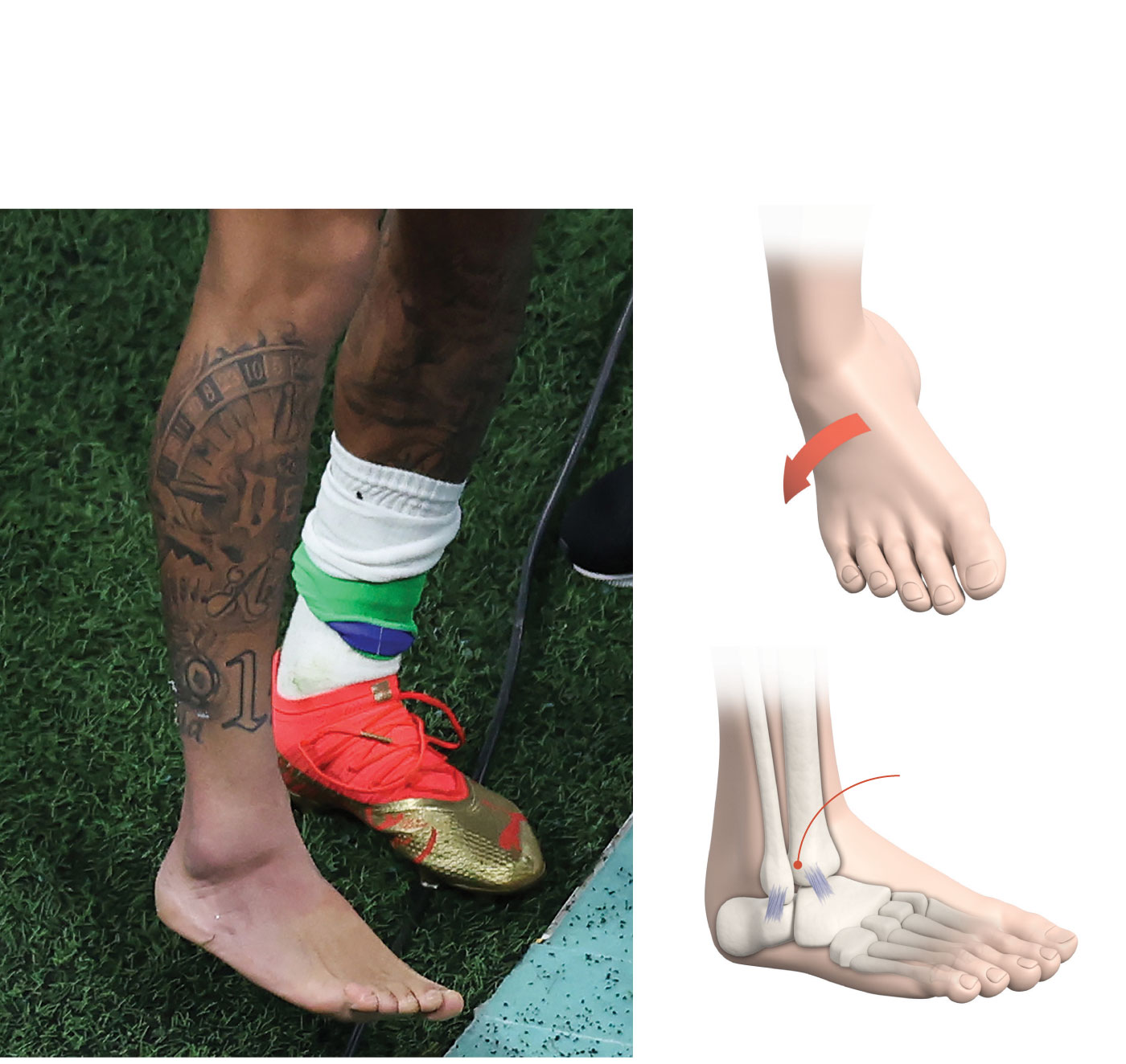 Neymar fora da Copa? Entenda. – ShowNews